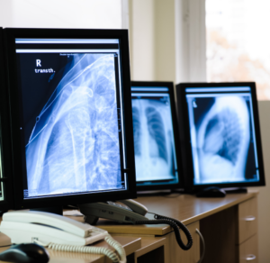 Digital X-ray – University Center Imaging
